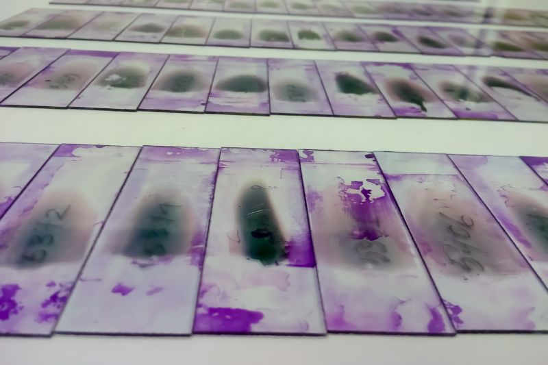 News | Active Silicon | Digital slide scanners for better pathology