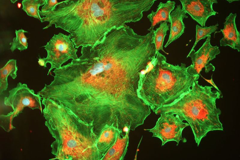 News | Active Silicon | Digital slide scanners for better pathology